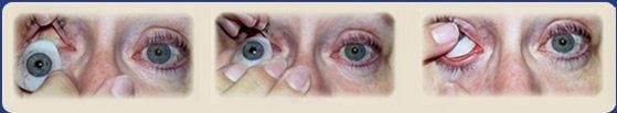 Your Prosthesis