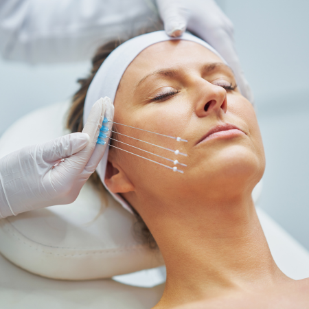 Different Types of PDO Threads and Their Benefits