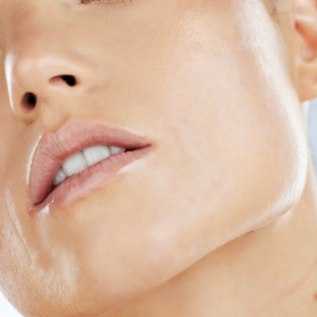 Things to do Before and After a PDO Thread | MINT™ PDO