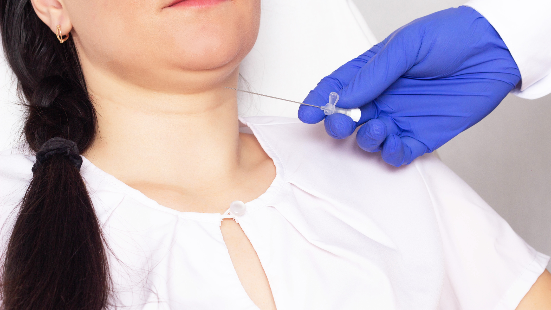 Non-Surgical Treatments for Chin Enhancement