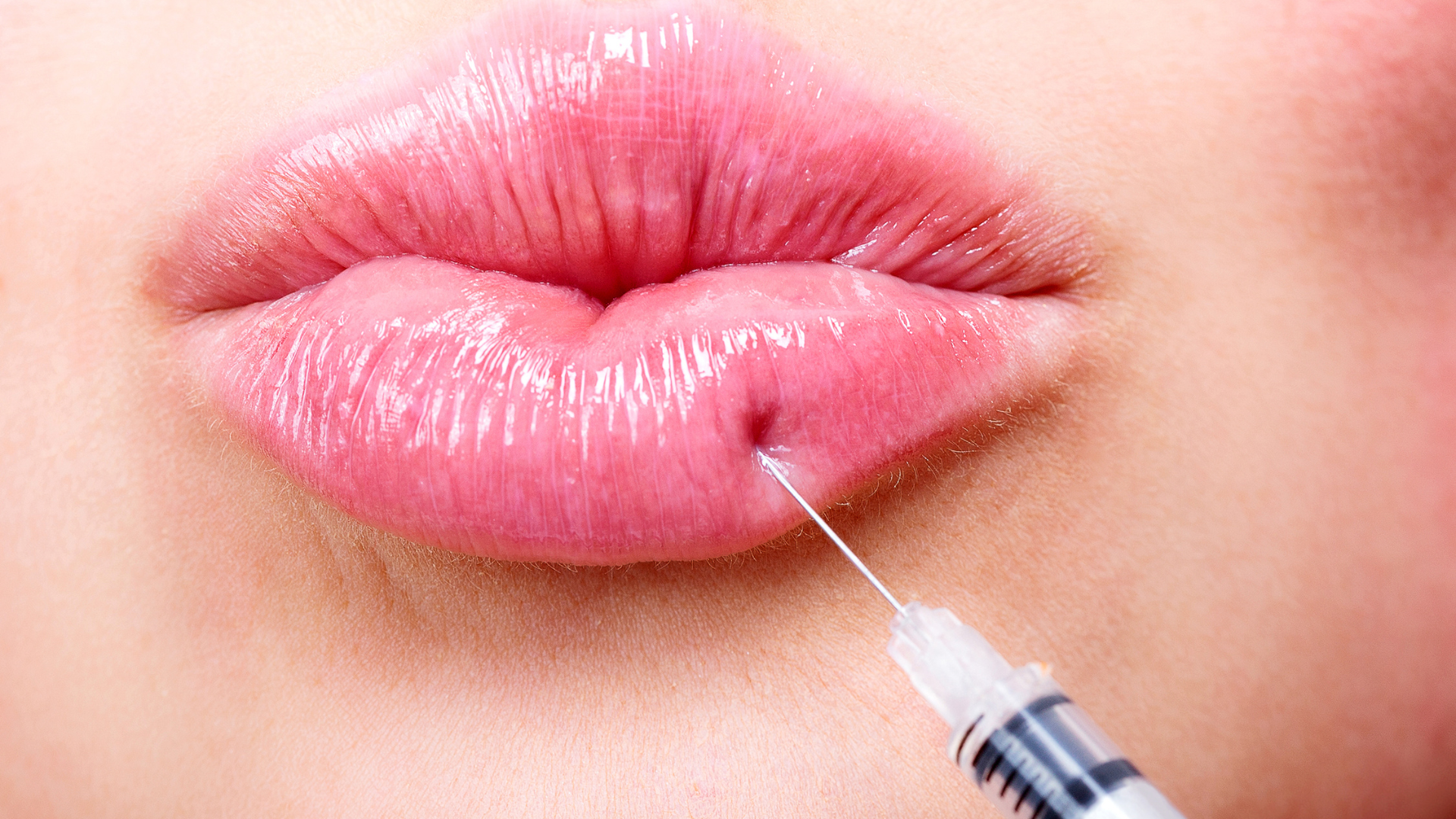 Dermal Fillers vs. PDO Thread Lifts: Which One Is Better For Me?