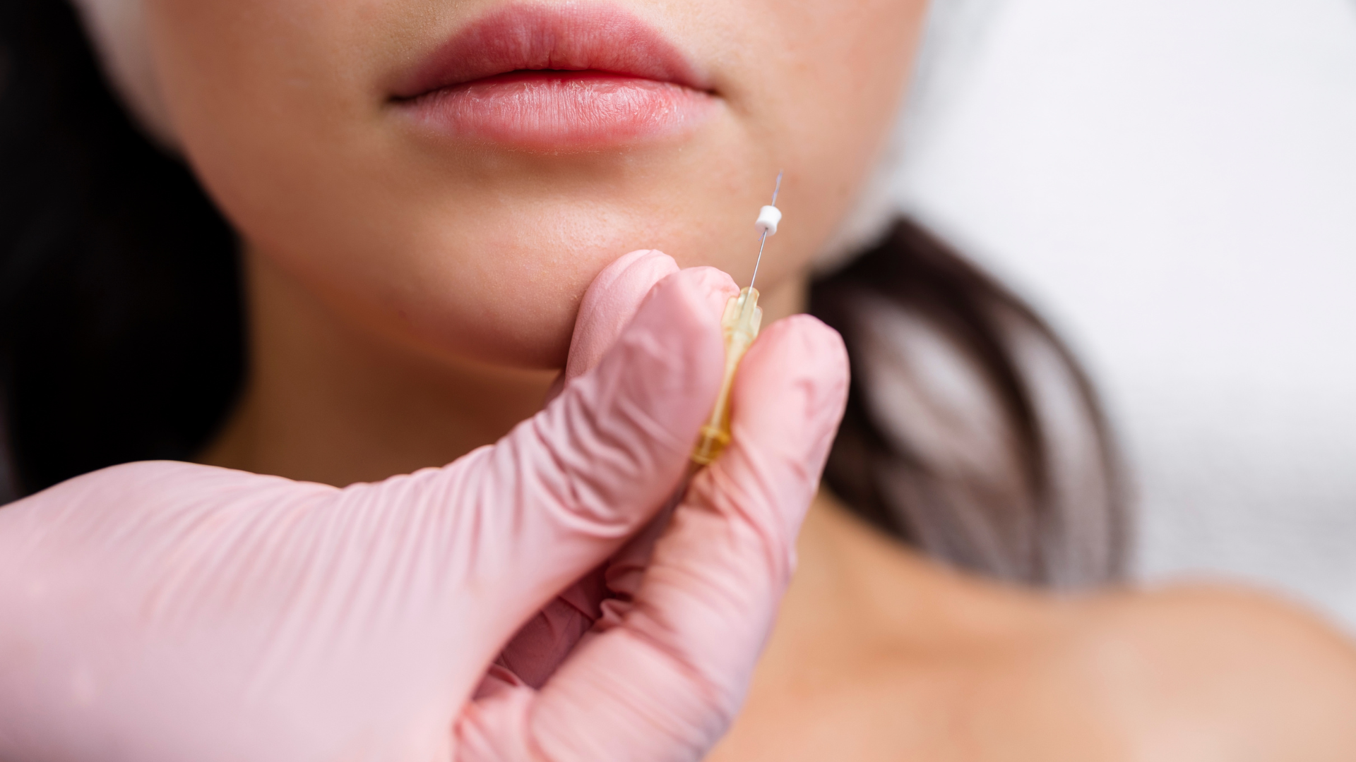 PDO Threads for Lips vs. Lip Filler