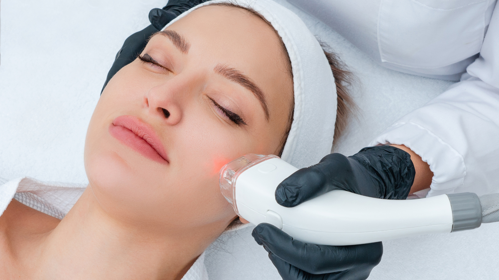 PDO threads vs Other Skin Tightening Methods: A Comparison