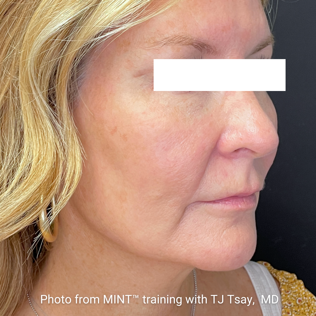 Information on MintPDO Treatments and Services - For Patients Mint PDO