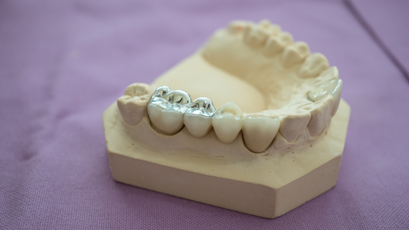 Composite vs. Amalgam Fillings: Which is Best for You?