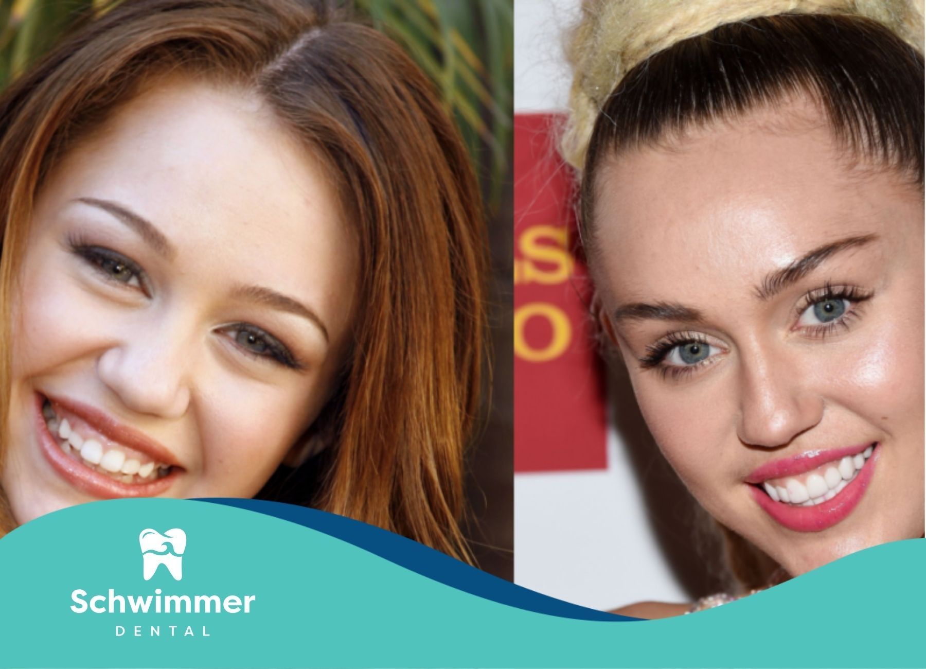 Celebrities With Cavities 60 Photos - Moonagedaydream.film