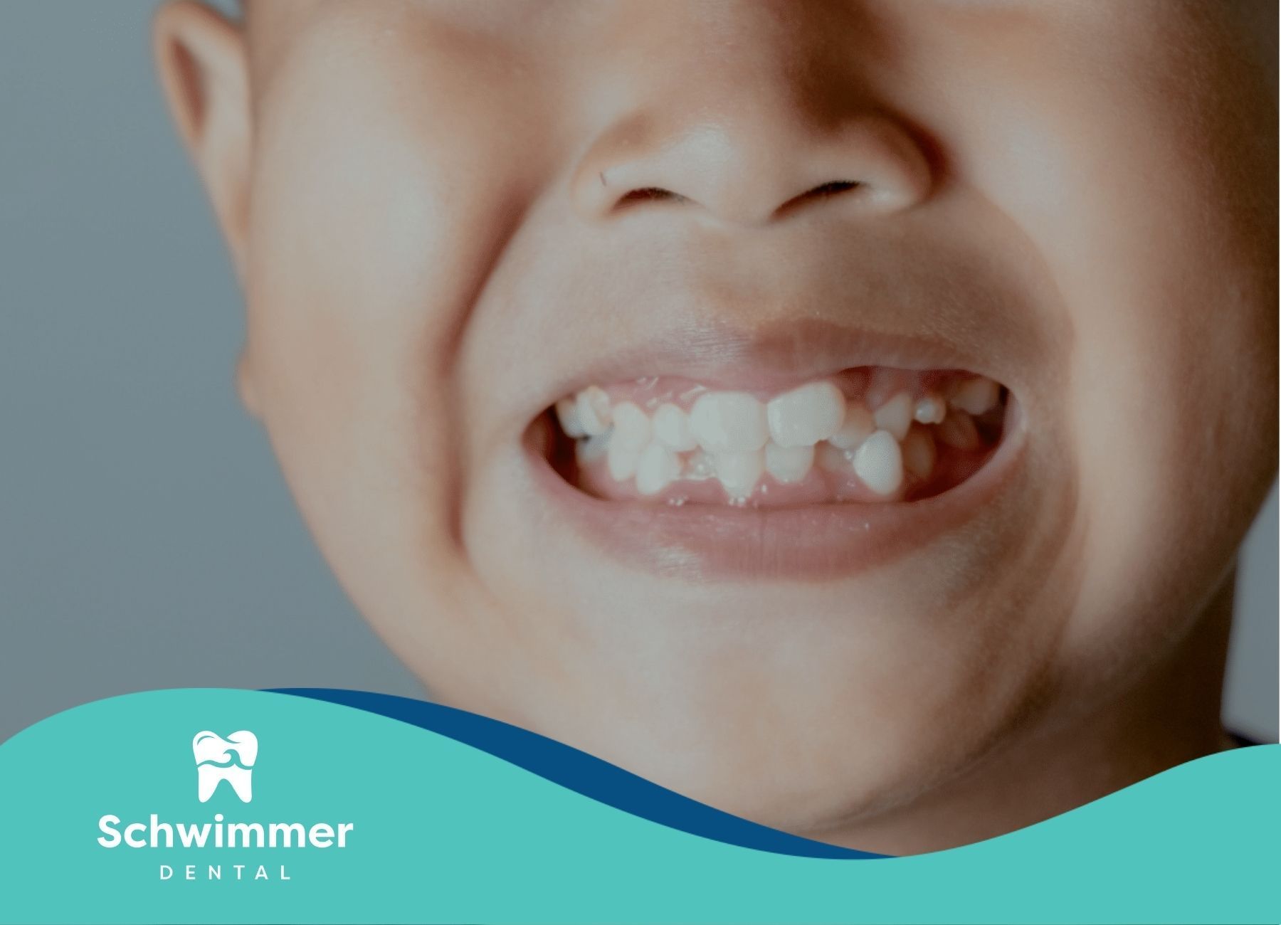 Solutions & Options to Fix an Extra Tooth | Schwimmer Dental
