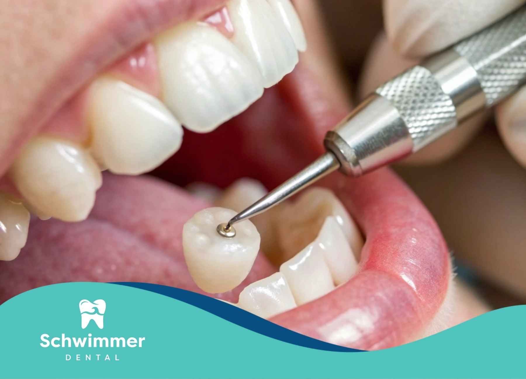 What Is TMJ? Everything You Need to Know | Schwimmer Dental