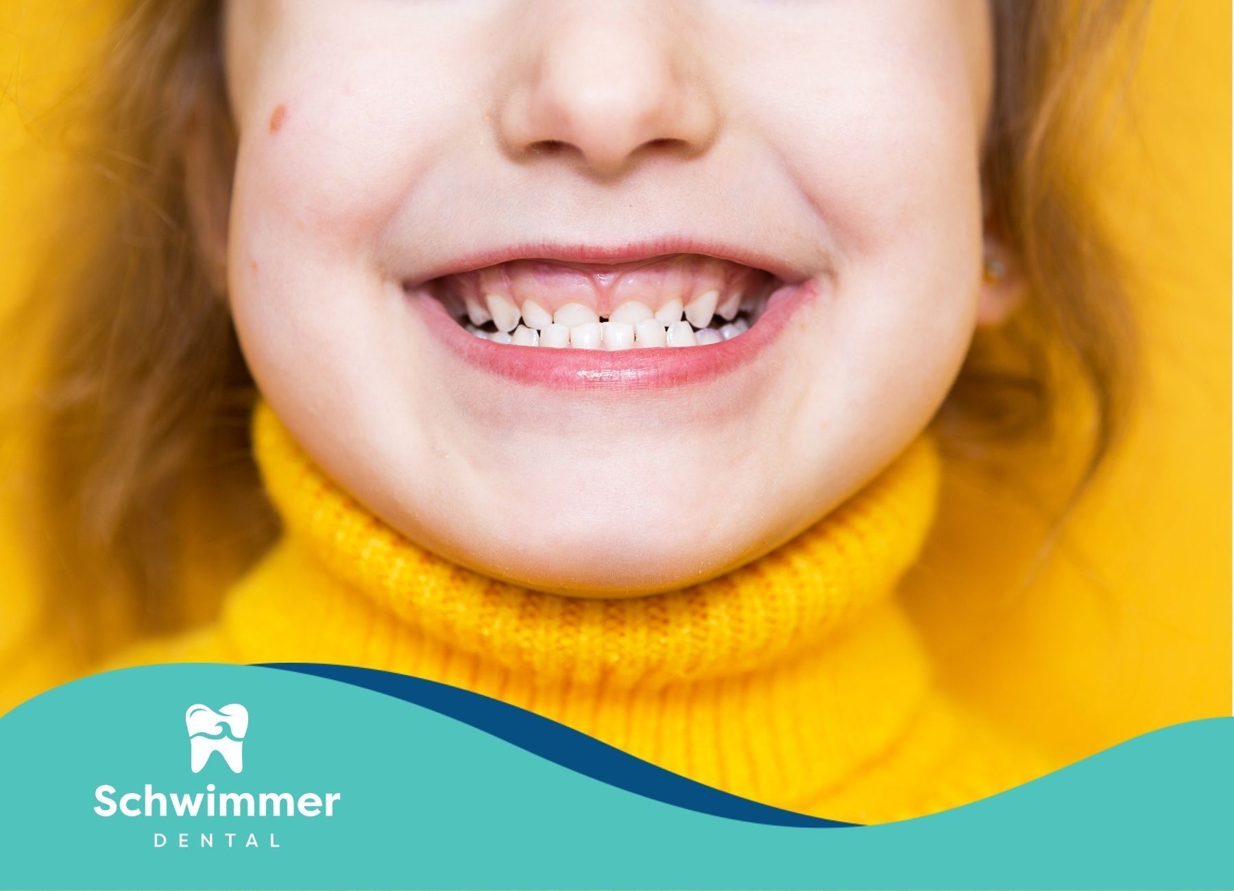 Why Do Teeth Shift and How to Stop It | Schwimmer Dental