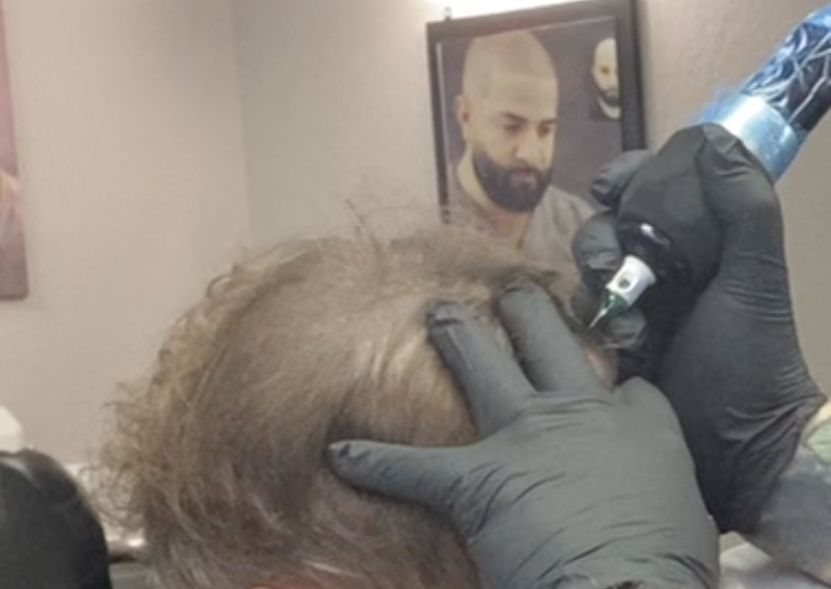 How To Fnd The Best Scalp Micropigmenation (SMP) Artists In Tampa