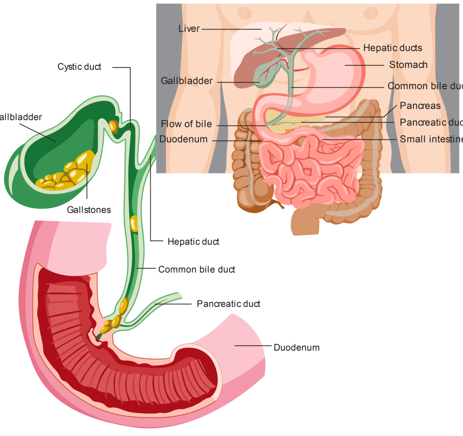 Gallbladder Surgery Info | 360 Surgery | VIC