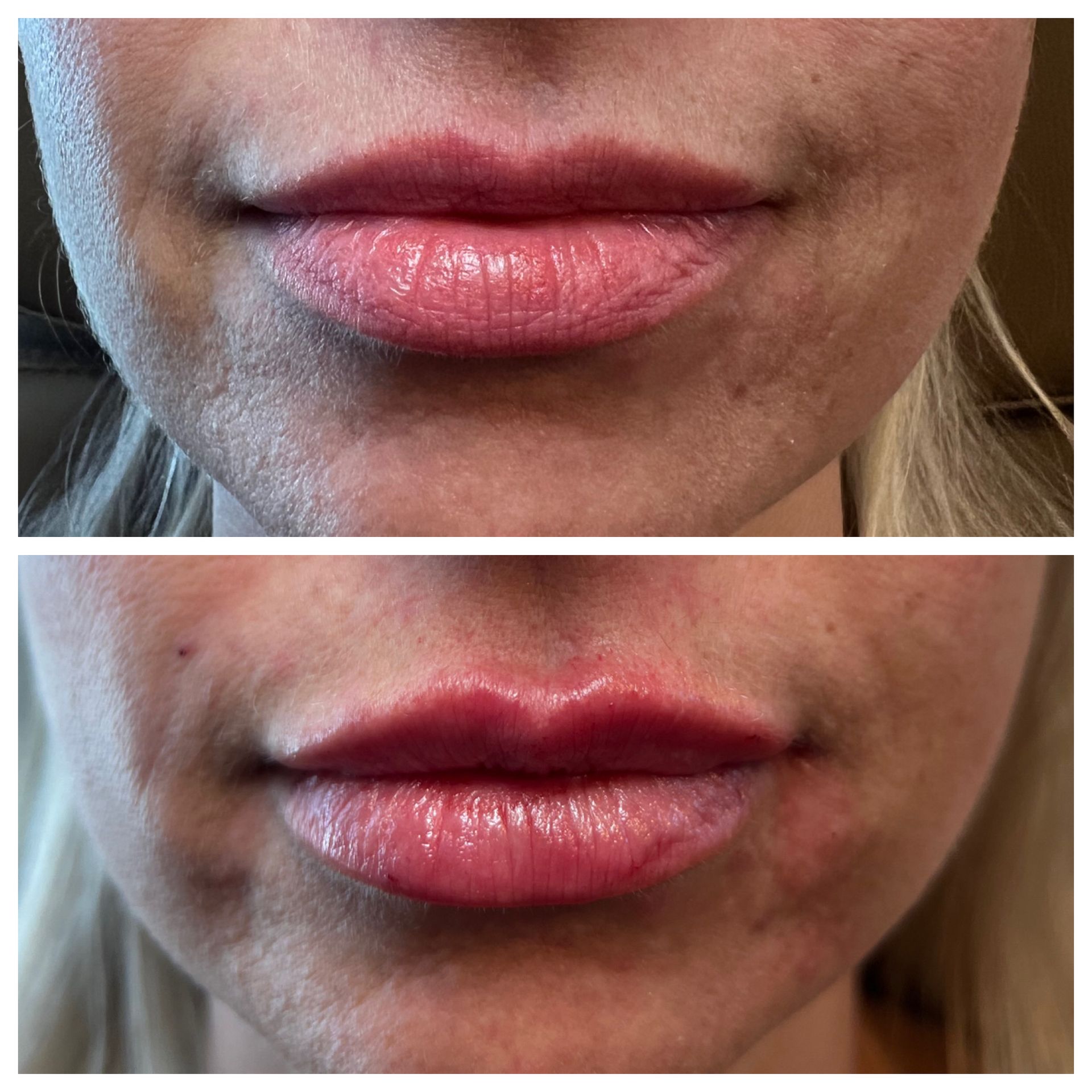 Natural Beauty Aesthetics | Westfield, IN | Solid Wellness