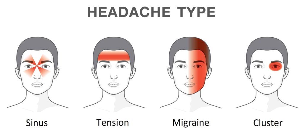 9 Common Types of Headaches and When to Consult a Doctor