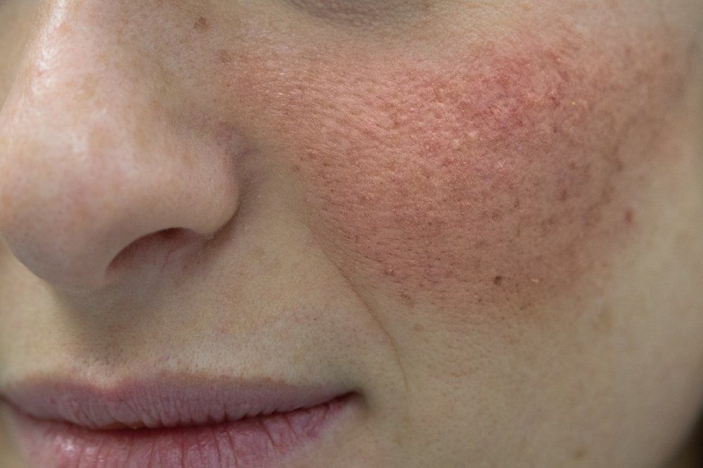 Dermatologia | Albenga, SV | Dr. Politi Gianraffaele