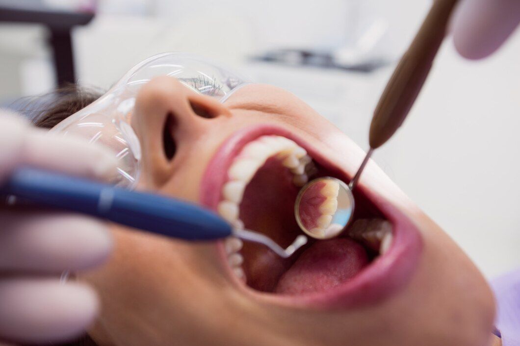 Guide to Dental Crown Lengthening Procedure