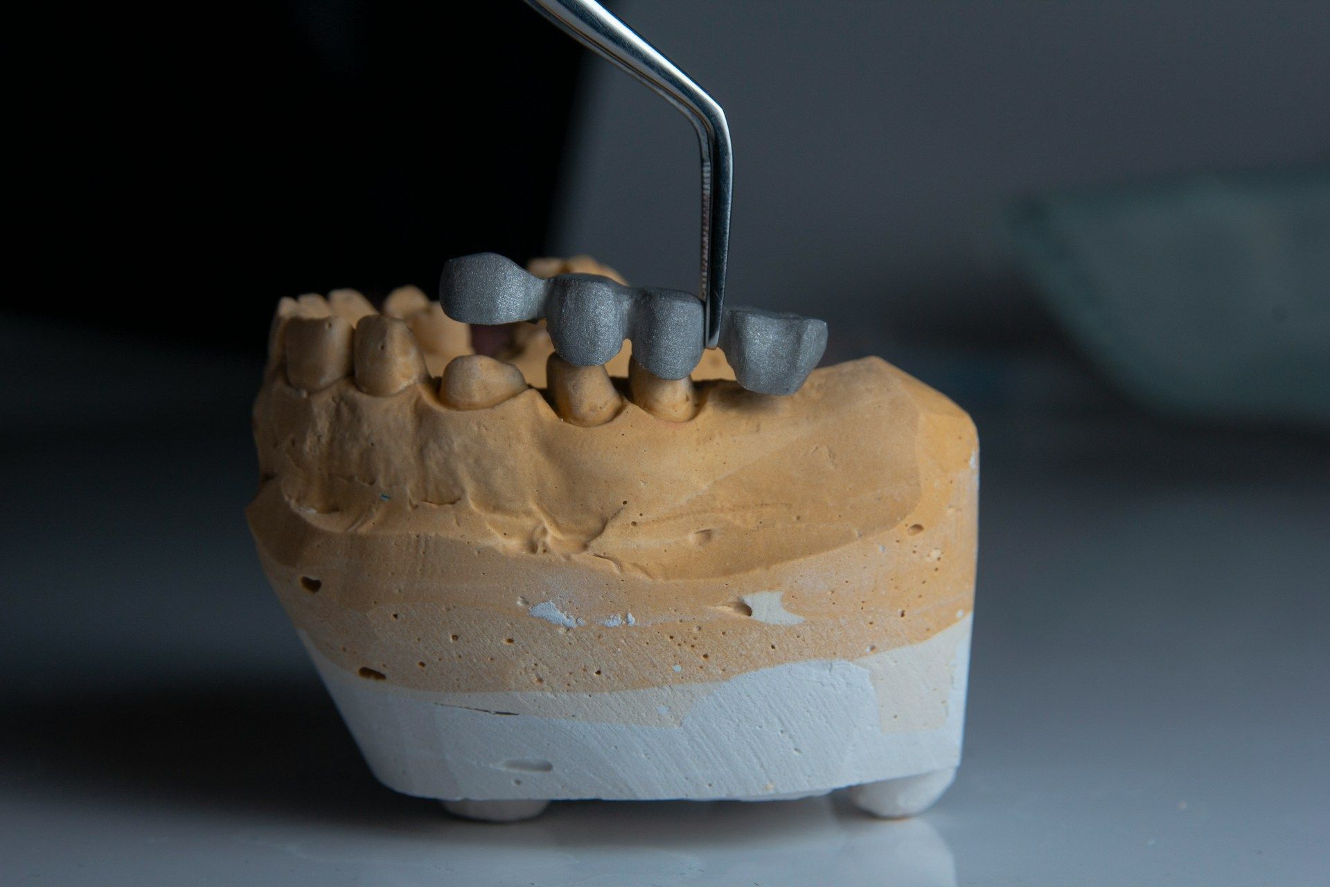 Guide to Dental Crown Lengthening Procedure
