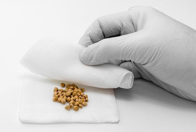 Gallstones Removal Surgery in Singapore Colorectal Clinic