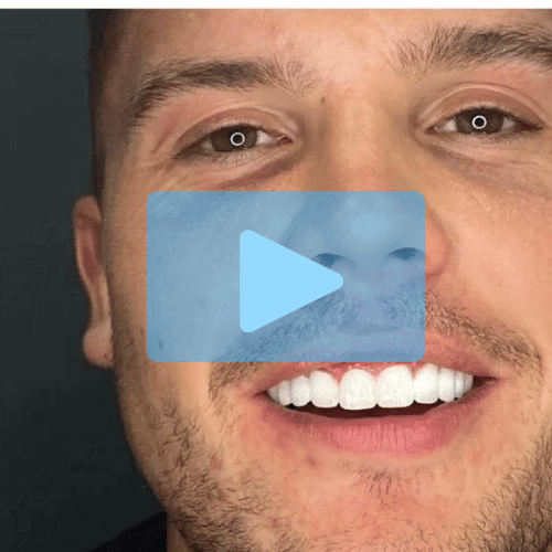 UK Smiles - #1 In Turkey Teeth Dental Treatments