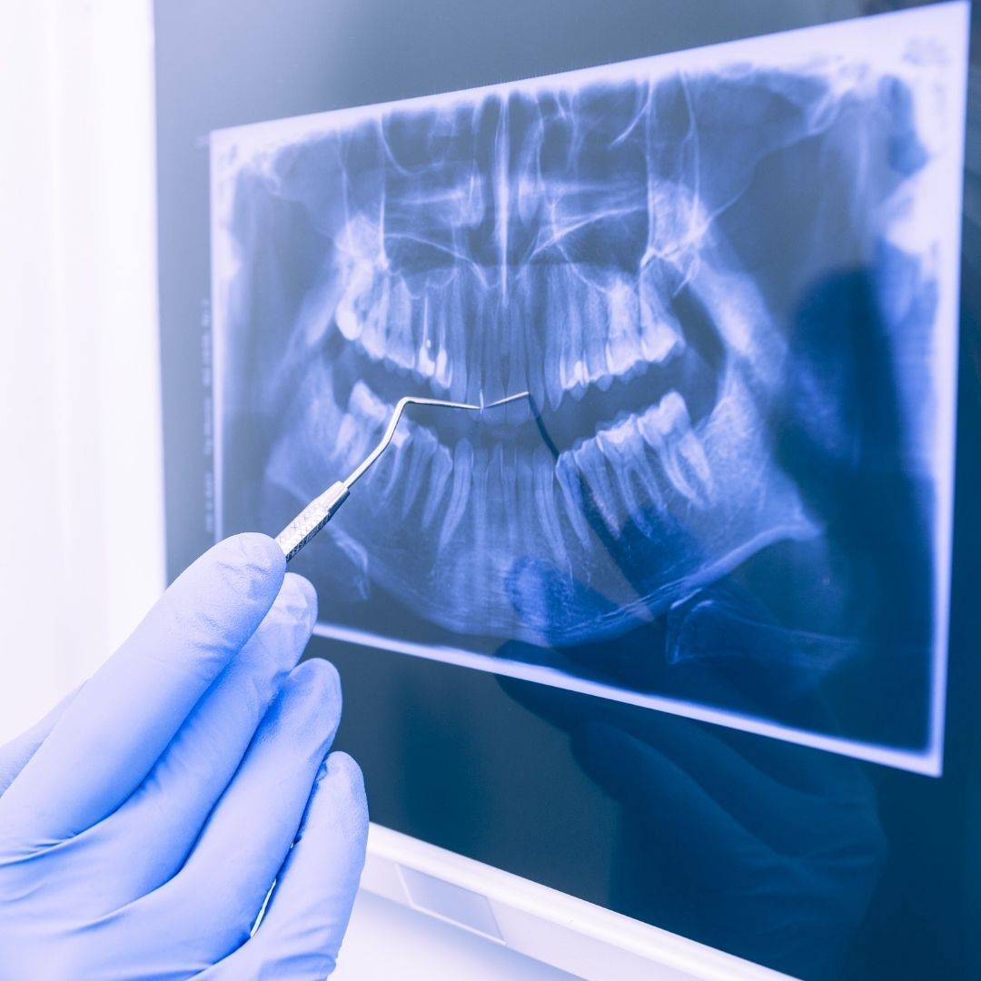 Oral Surgeon Washington DC | Dental & Maxillofacial Surgery In DC Area