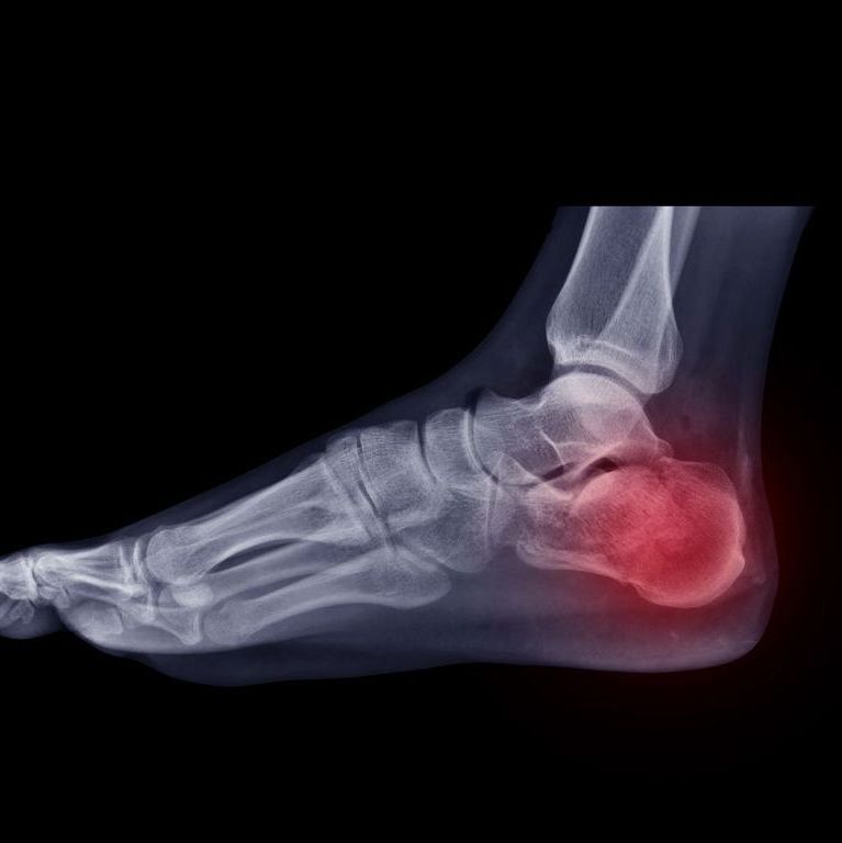 Onsite Imaging and Radiography | Southwest Austin Foot And Ankle Clinic