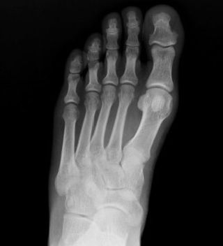 Foot and Ankle Clinic Austin, TX | Southwest Austin