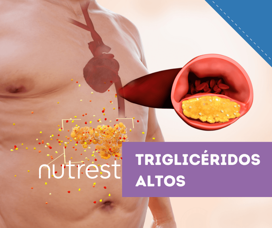¿Qué alimentos comer para bajar los triglicéridos?