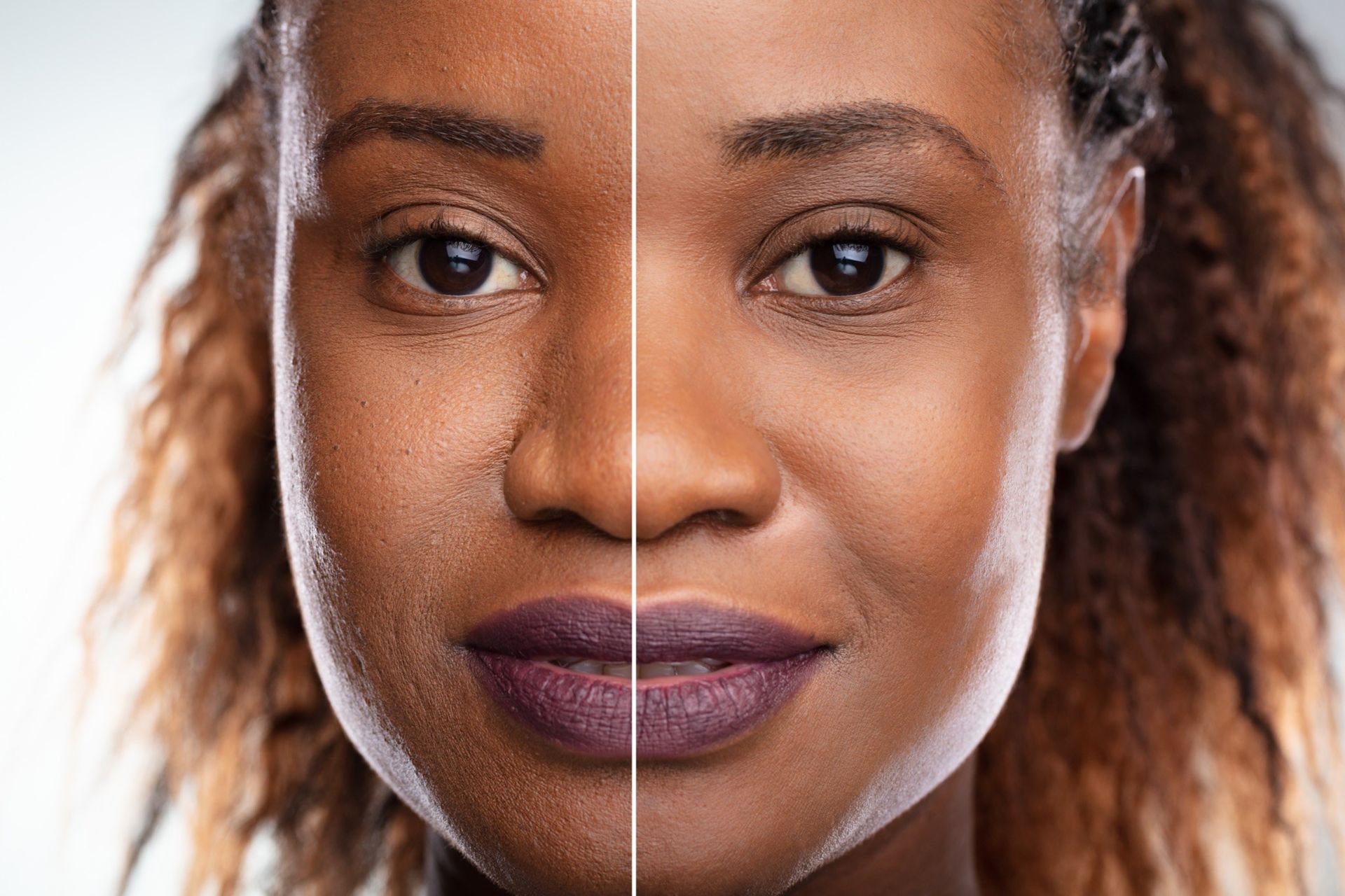 What Is Microdermabrasion And How Does It Help Your Skin 