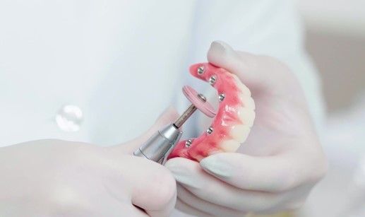 Prótese protocolo: saiba tudo sobre ela