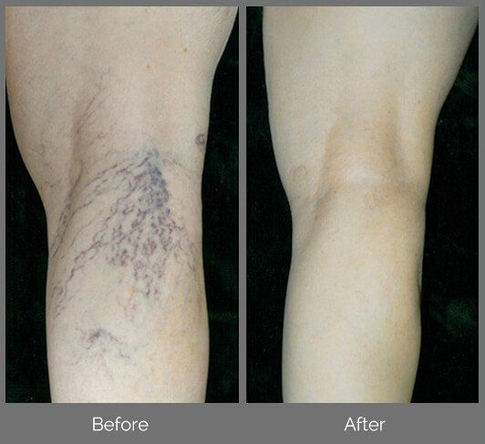 Susan Morris Vascular Surgeon