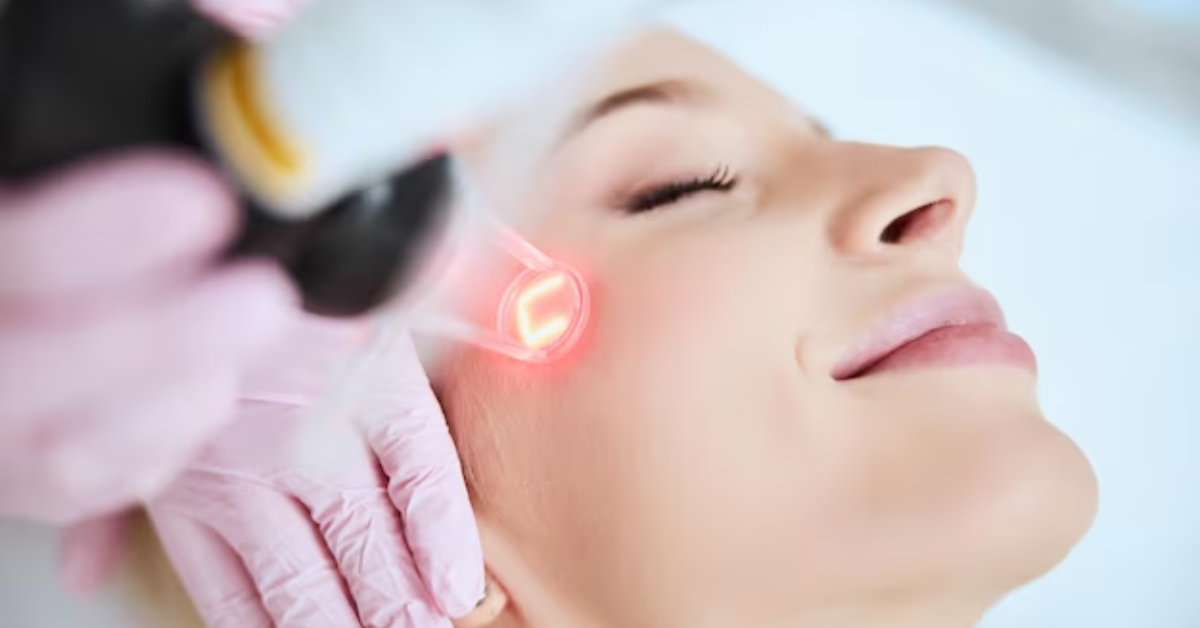 "Unveiling Facial Hair Mysteries: Causes and Laser Solutions