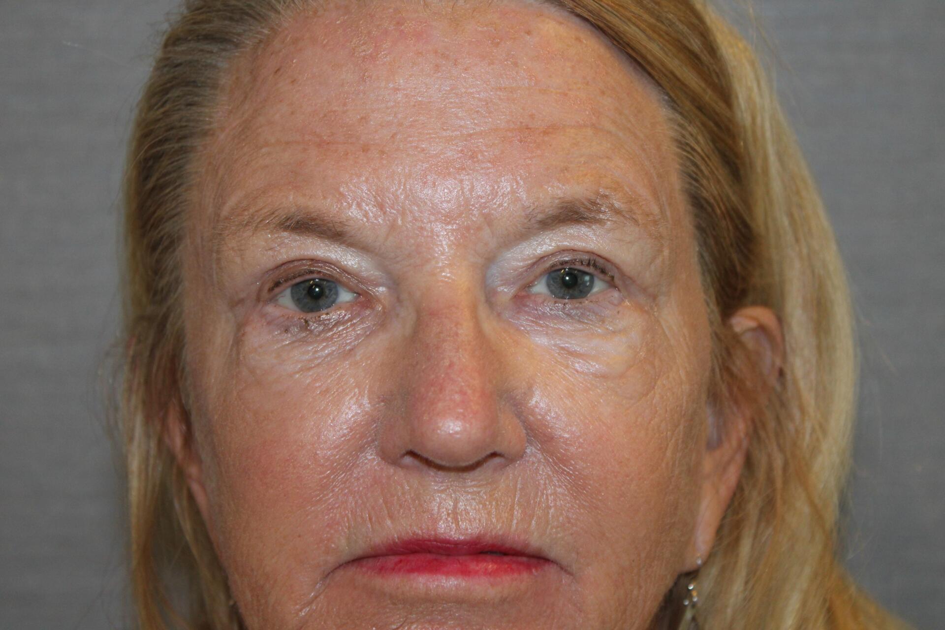 Plastic Surgeon Connecticut | Boris Goldman, MD