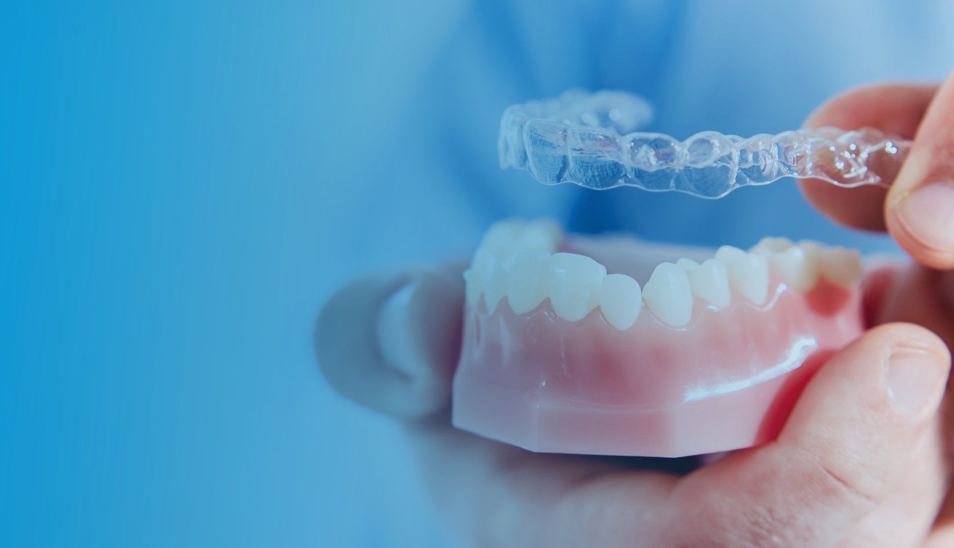 What are Some Tips for the New Invisalign Users?