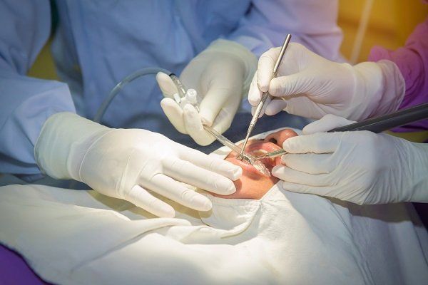 Saiba o que é profilaxia dental e quais os benefícios