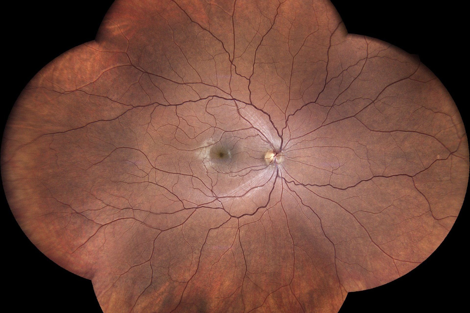 Vision Care Associates Optometry Charlotte NC - Home