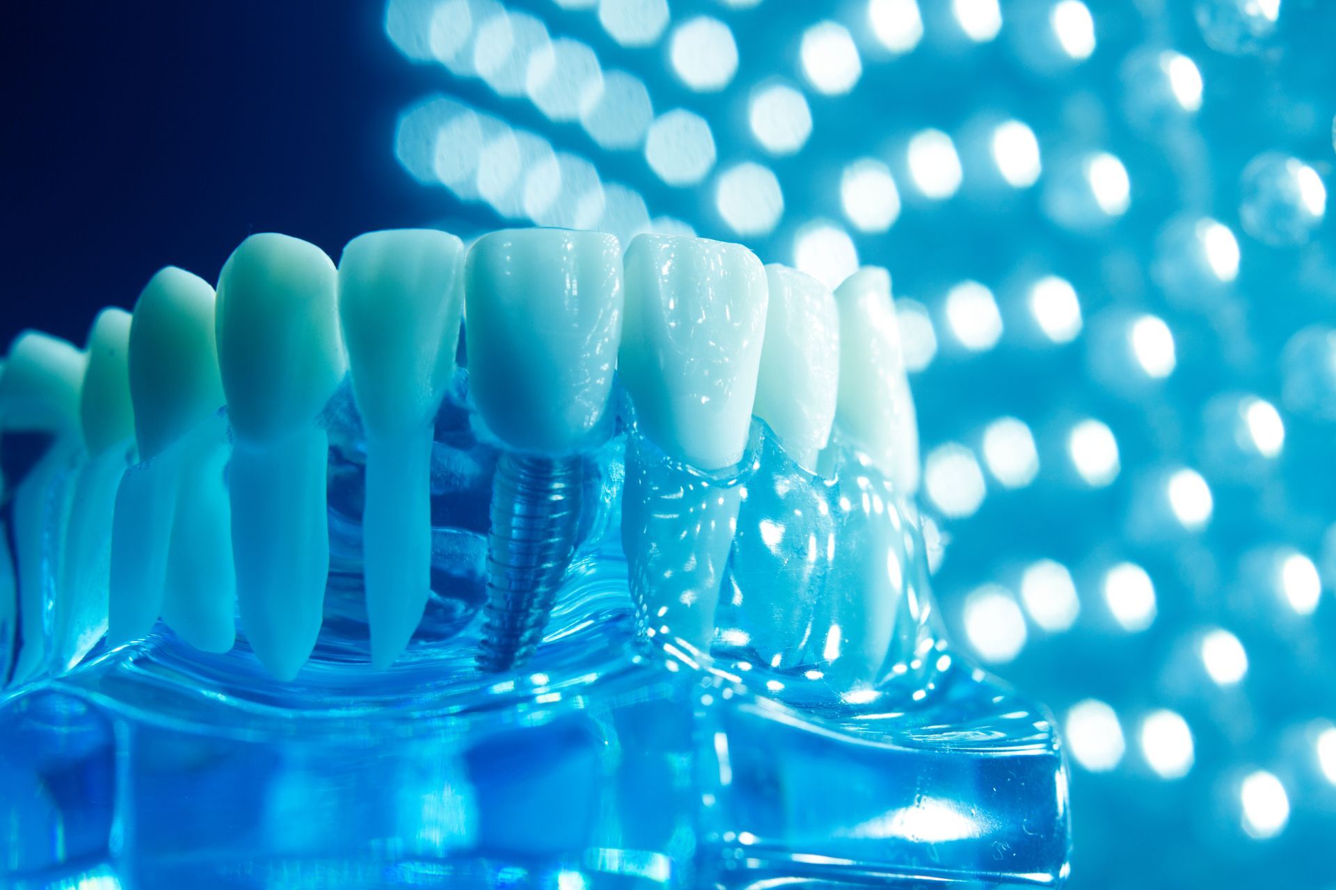 Cambridge Novolab Dental Laboratory | HOME | Dental Laboratory ...