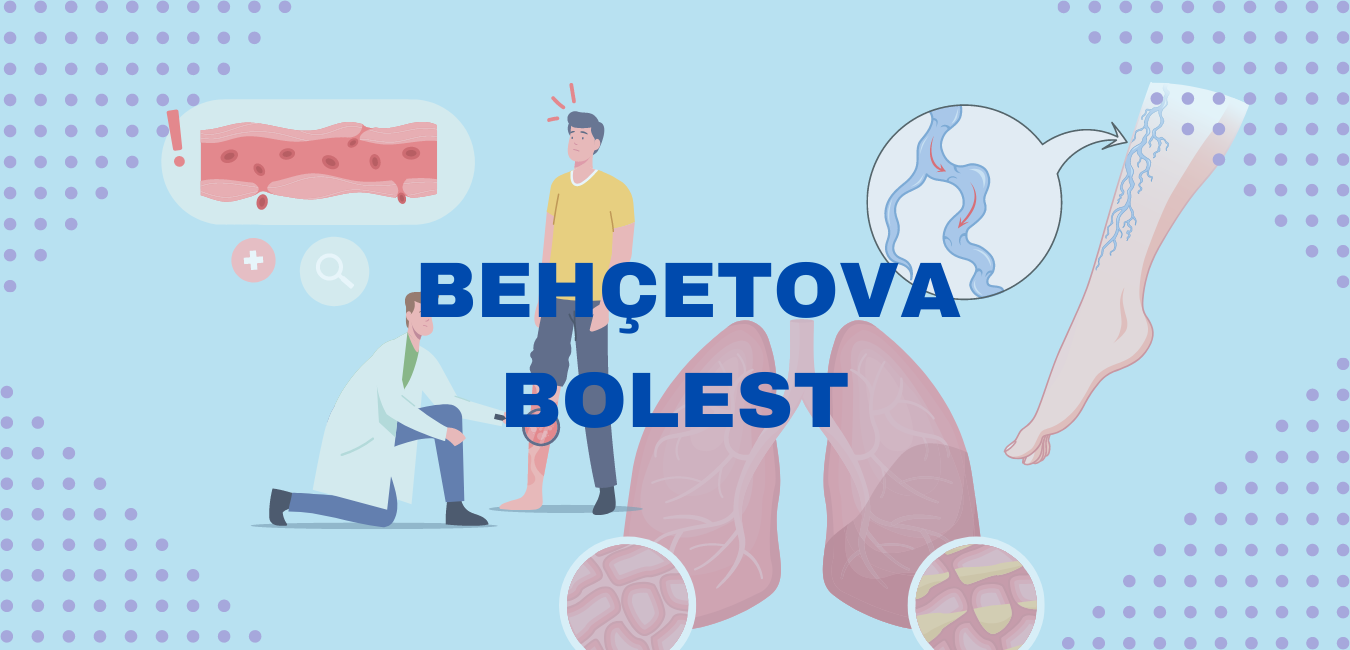 Behcetova bolest