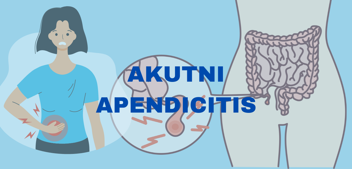 Akutni apendicitis