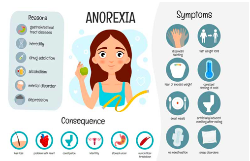 ANOREKSIJA NERVOZA I BULIMIJA