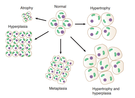 Stres: najveći neprijatelj imuniteta