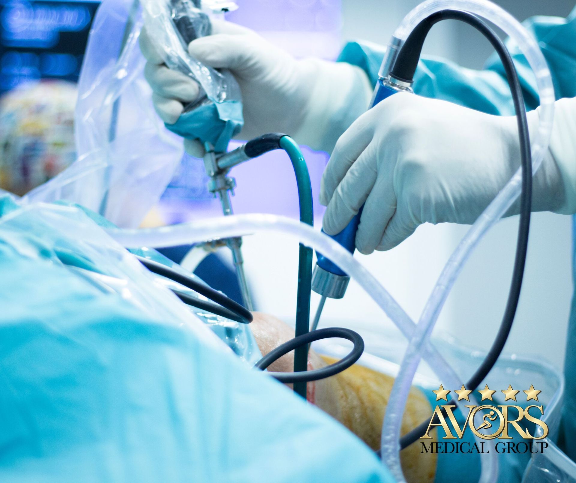 Arthroscopy in Palmdale, CA with Dr. Kofi Agyeman