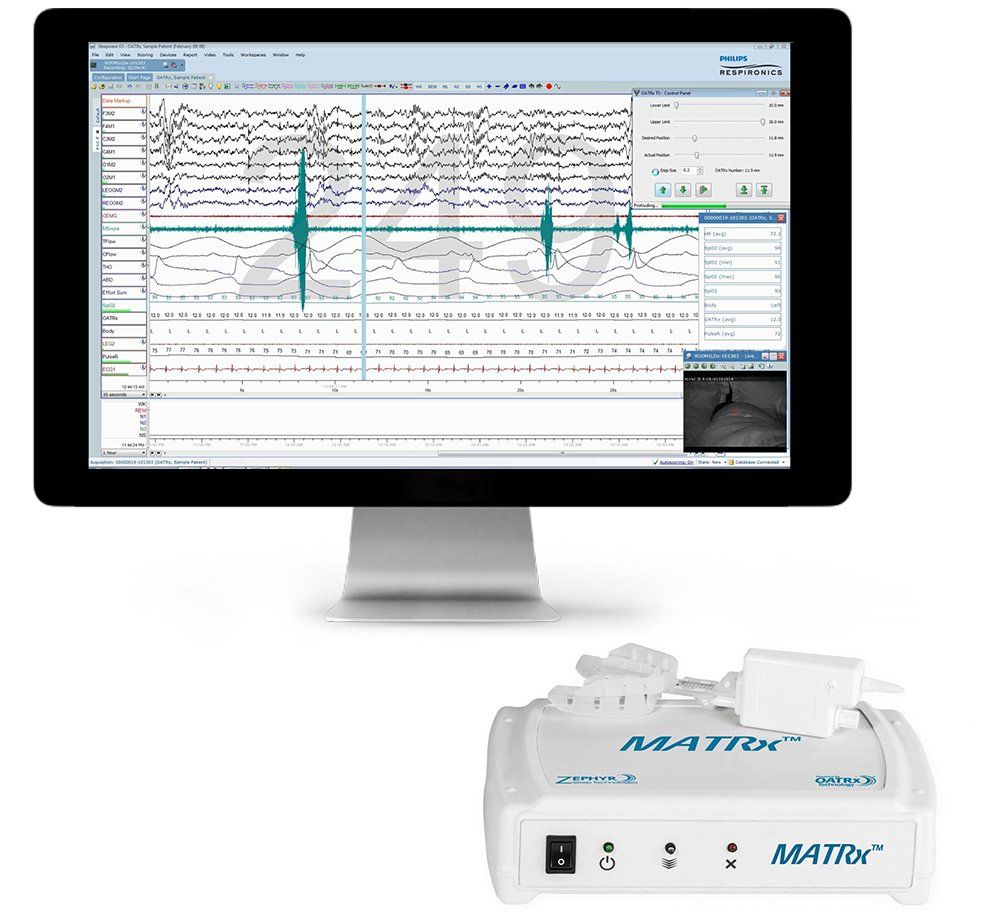 MATRx In Lab Sleep Study An Overview