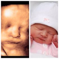 3D 4D HD LIVE Elective Ultrasound | Hilliard - Columbus, Ohio