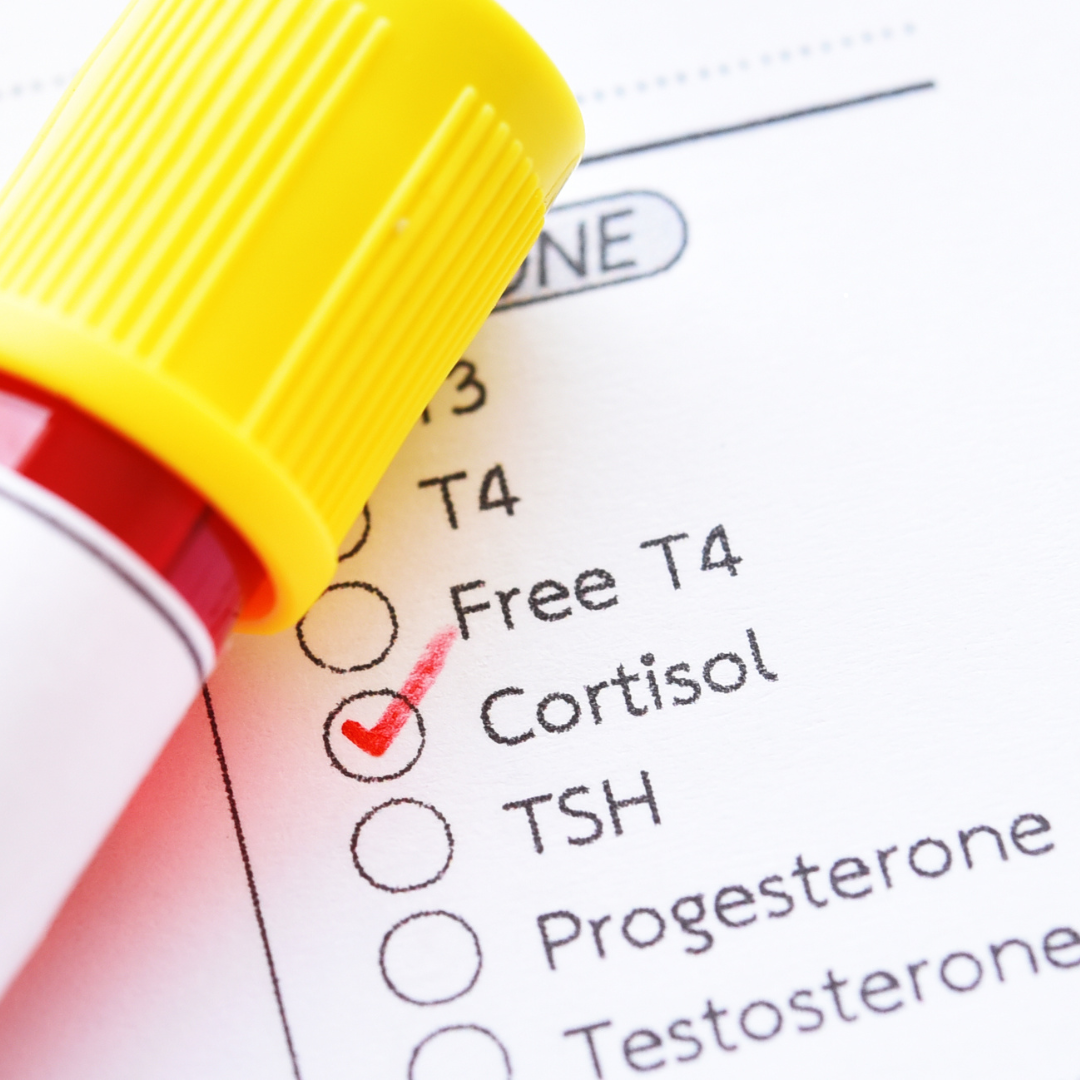 Hormone Labs Explained: What to Test and Why