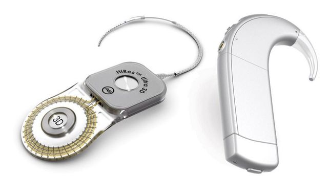 Cochlear Implant Freedom