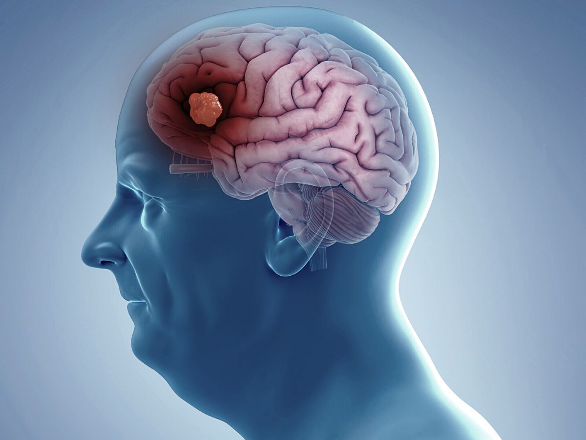 Conheça o Tratamento REAC