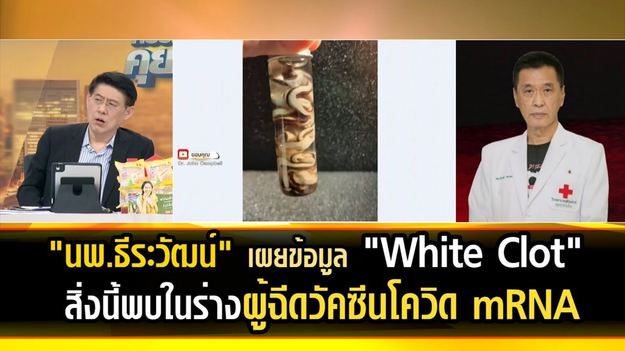 "นพ.ธีระวัฒน์" เผยข้อมูล "White Clot" สิ่งนี้พบในร่างผู้ฉีดวัคซีน mRNA