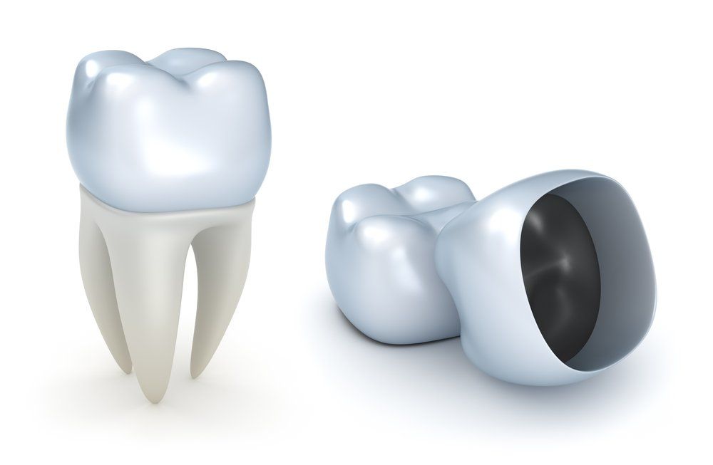 Fillings vs. Crowns: Which do You Need?