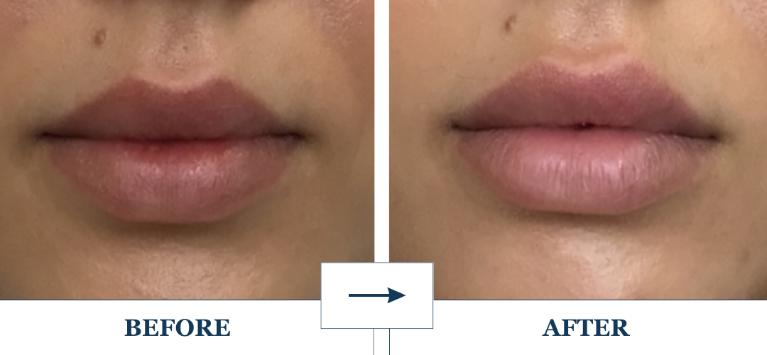 Magnolia Medical Wellness | Top Medspa in Enfield CT- BOTOX®, TRT