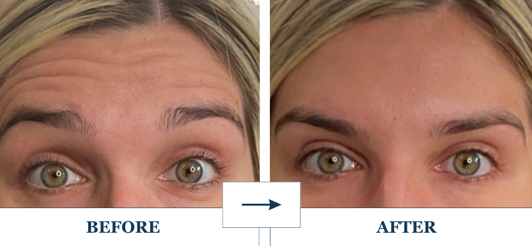 Magnolia Medical Wellness | Top Medspa in Enfield CT- BOTOX®, TRT