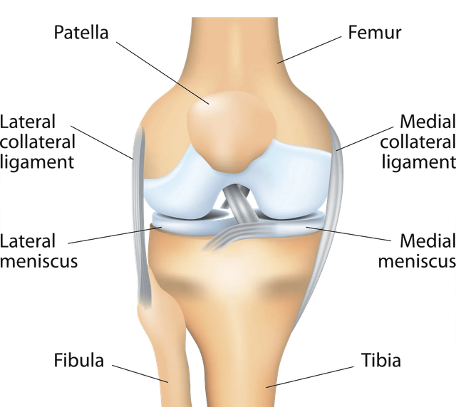Meniscus Tear